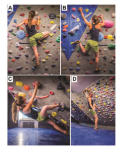 Mechanisms of Acute Knee Injuries in Bouldering and Rock Climbing Athletes